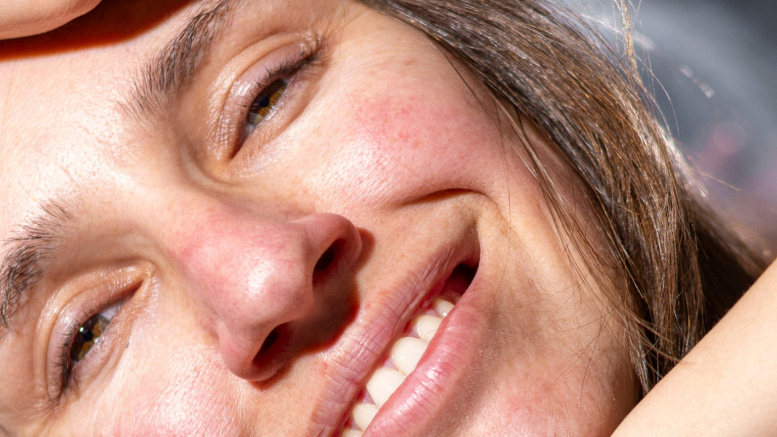 Everything you need to know about treating rosacea