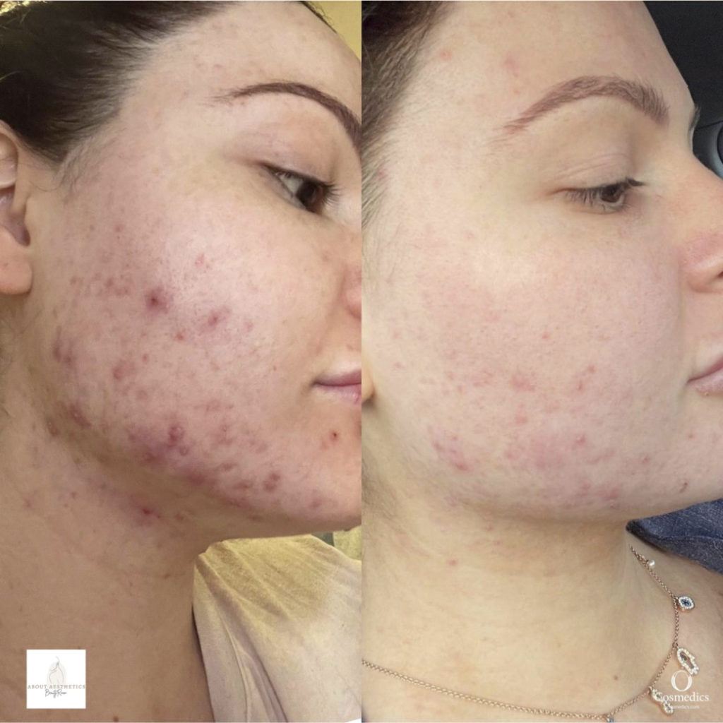 O COSMEDICS Pro Dermal Planning